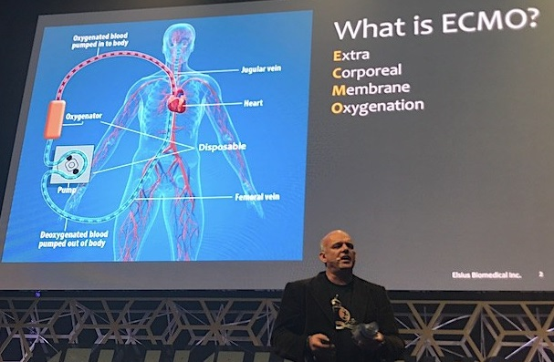 详解|ECMO是如何拯救危重病人的？